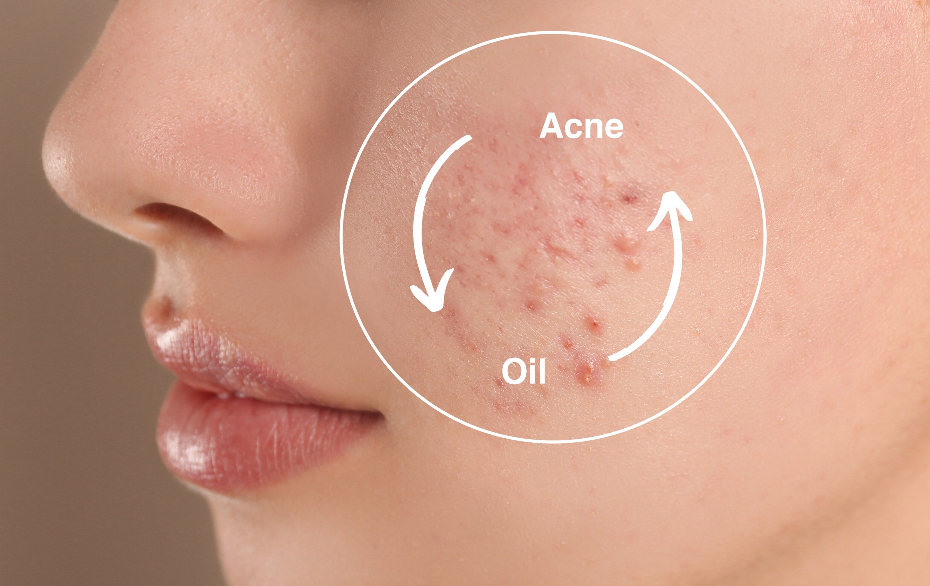 Oily skin type store